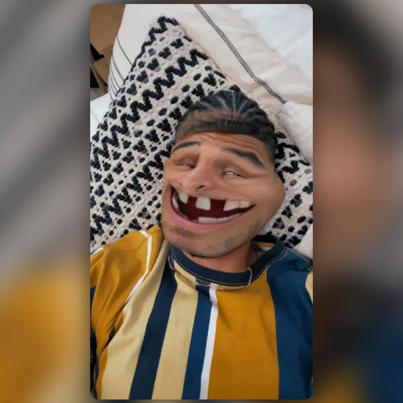 LOL Meme Face Lens by Snapchat - Snapchat Lenses and Filters