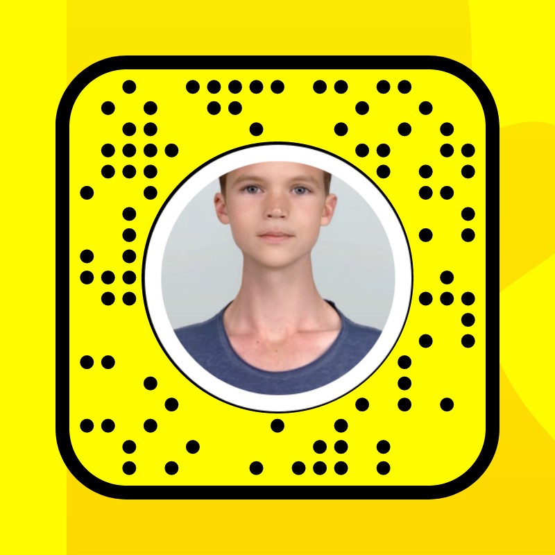 Baby Bald Lens by Abhinav Setia⭐️ - Snapchat Lenses and Filters