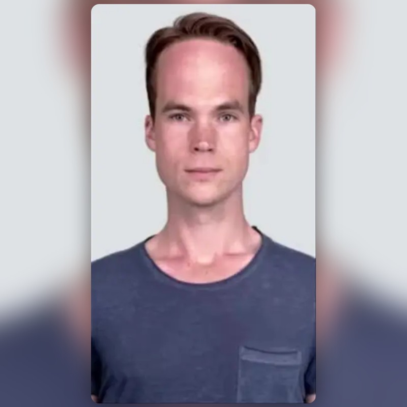 massive forehead Lens by louis - Snapchat Lenses and Filters