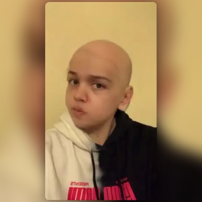 Bald Baby Filter by Brielle Garcia | Snapchat Lenses