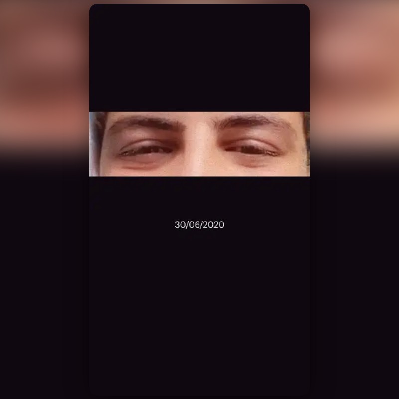 Curious Eyes Lens by Snapchat - Snapchat Lenses and Filters