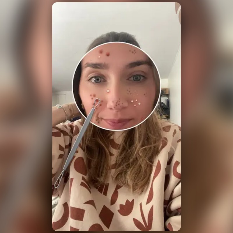 Acne Removal Filter by Snapchat | Snapchat Lenses
