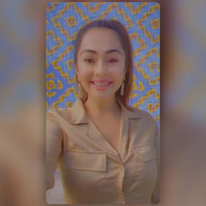 Sparkling Freckles Filter by Snapchat | Snapchat Lenses