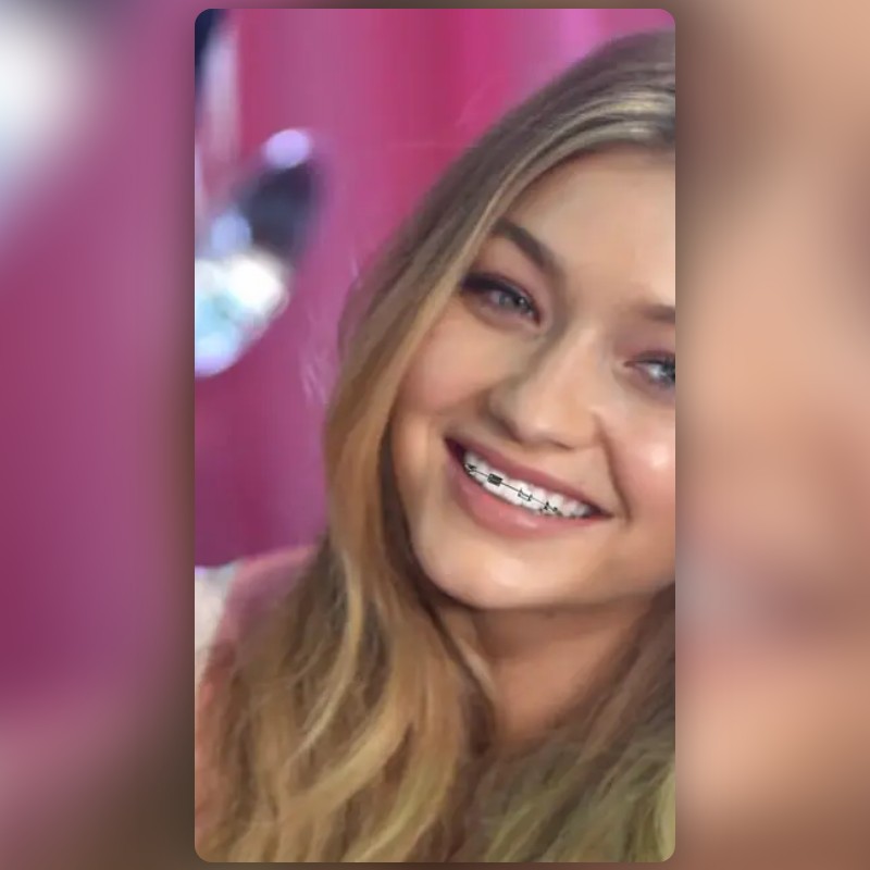 Braces Smile Filter by sARa | Snapchat Lenses